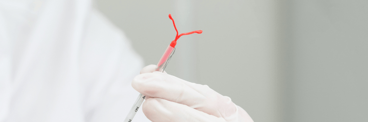 The Step-by-Step Guide to a Safe and Stress-Free IUD Removal – Lubracil