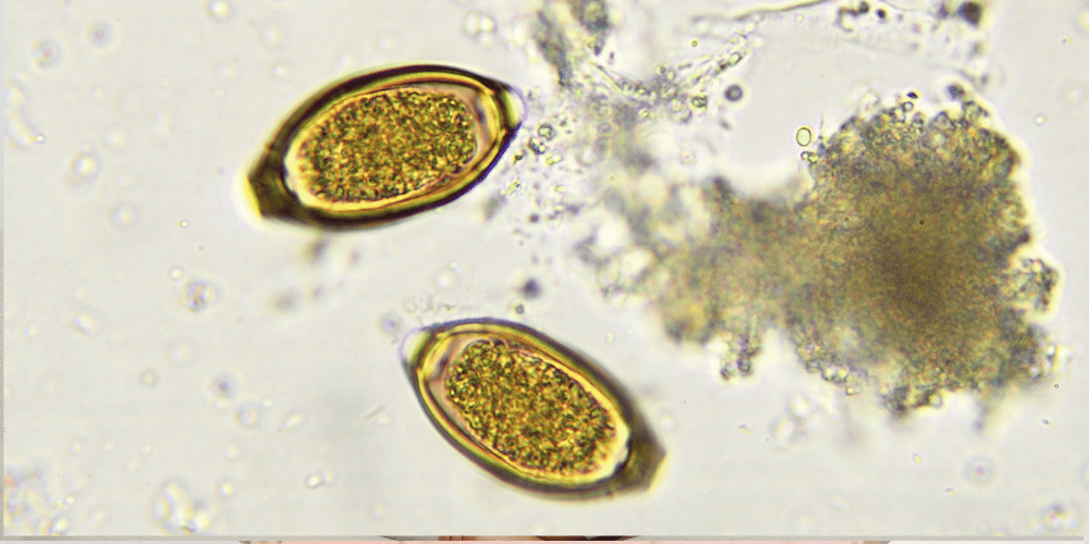 Why Are You Spotting These Trichomoniasis Symptoms? – Lubracil